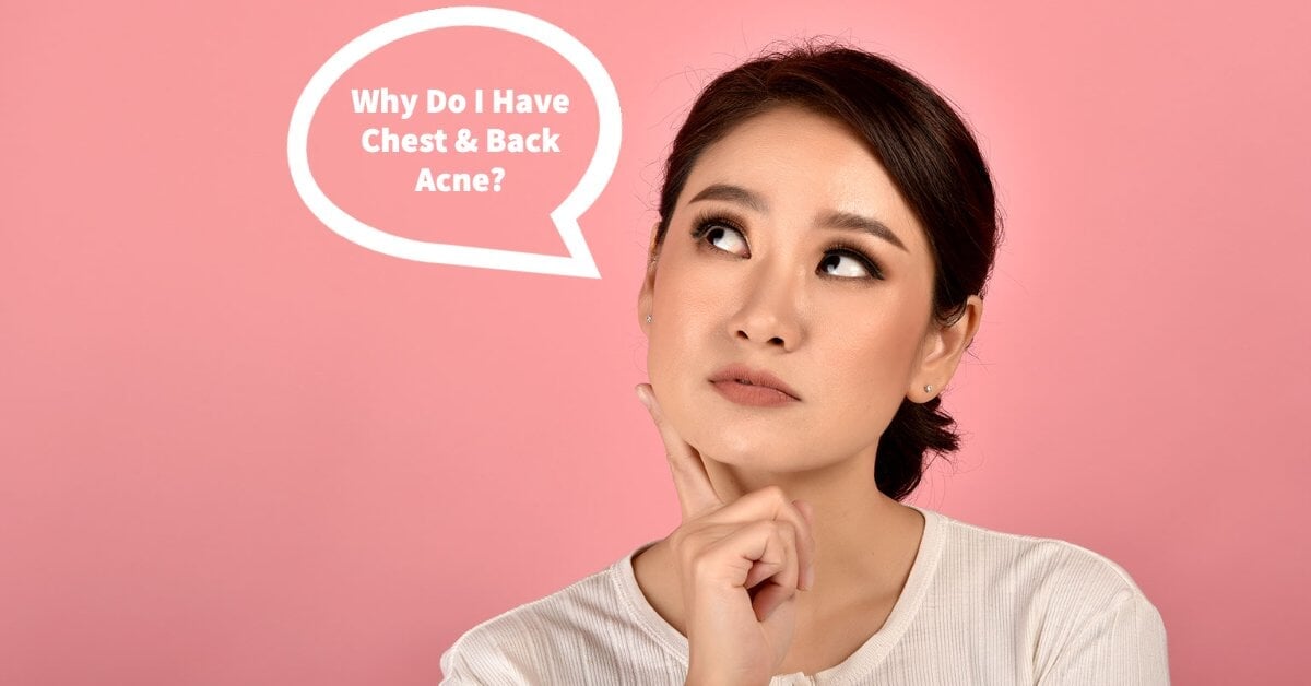 Why Do I Have Chest and Back Acne? | CLn Skin Care
